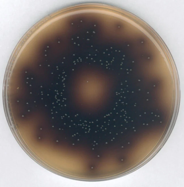AGAR BILIS ESCULINA ACIDA, DE ACUERDO A ISO 7899-2 PARA MICROBIOLOGIA ...